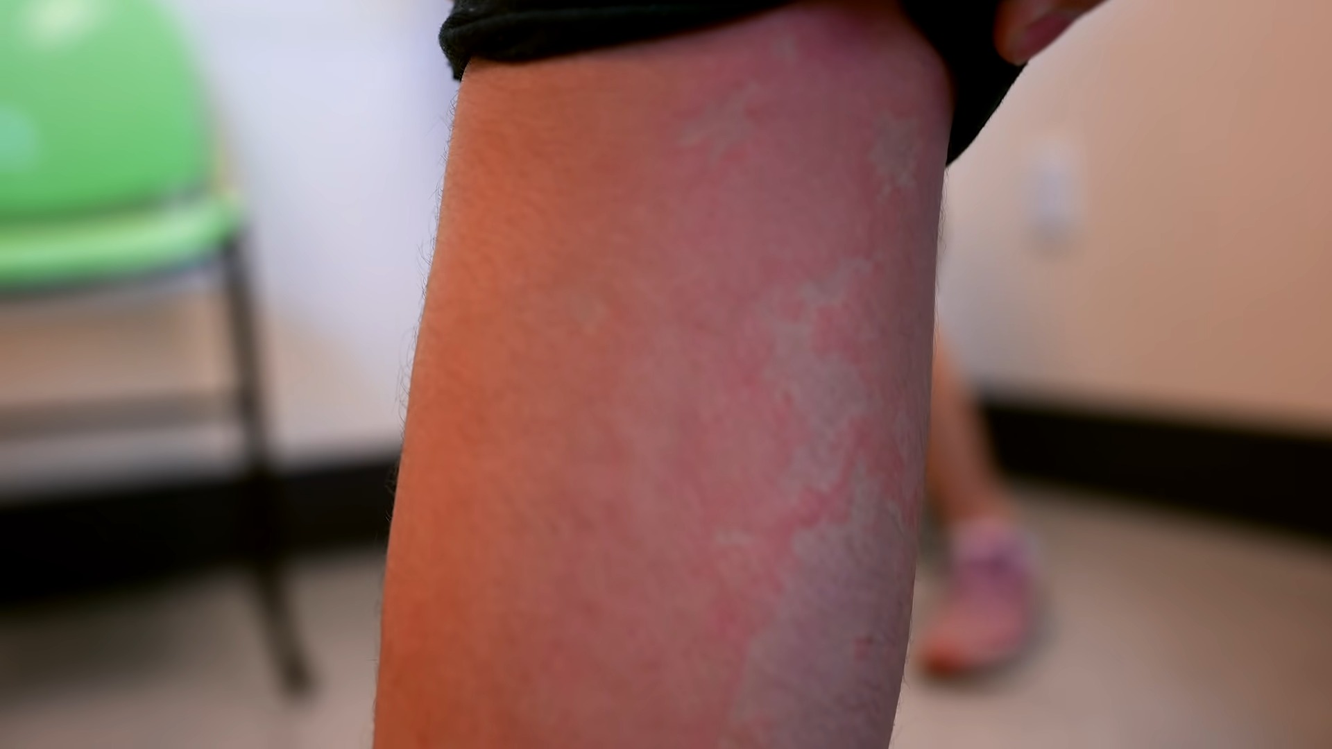 Can C4 Energy Drink Make You Itchy? Understanding Potential Side Effects